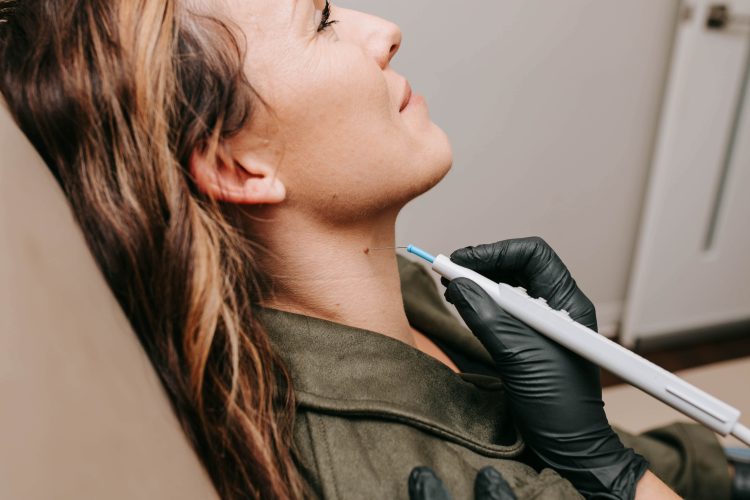 HYFRECATOR in MADISON, WI - ANEU Med Spa